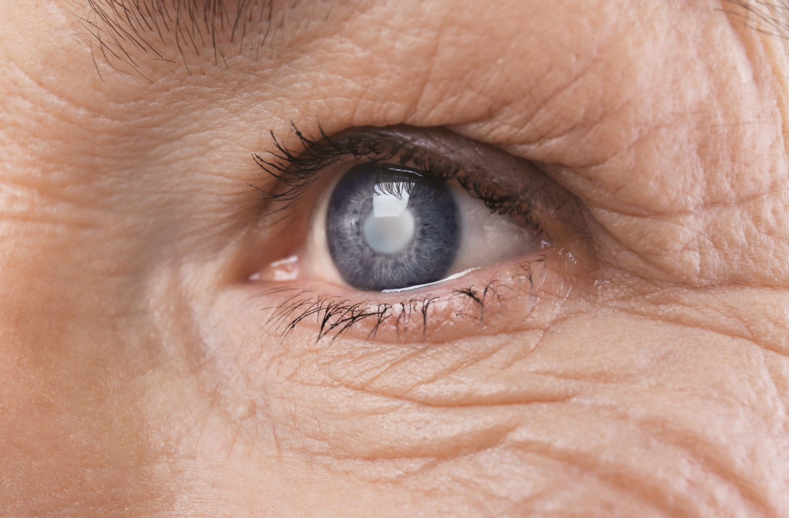 Do Cataracts Affect Night Vision? | Total Vision